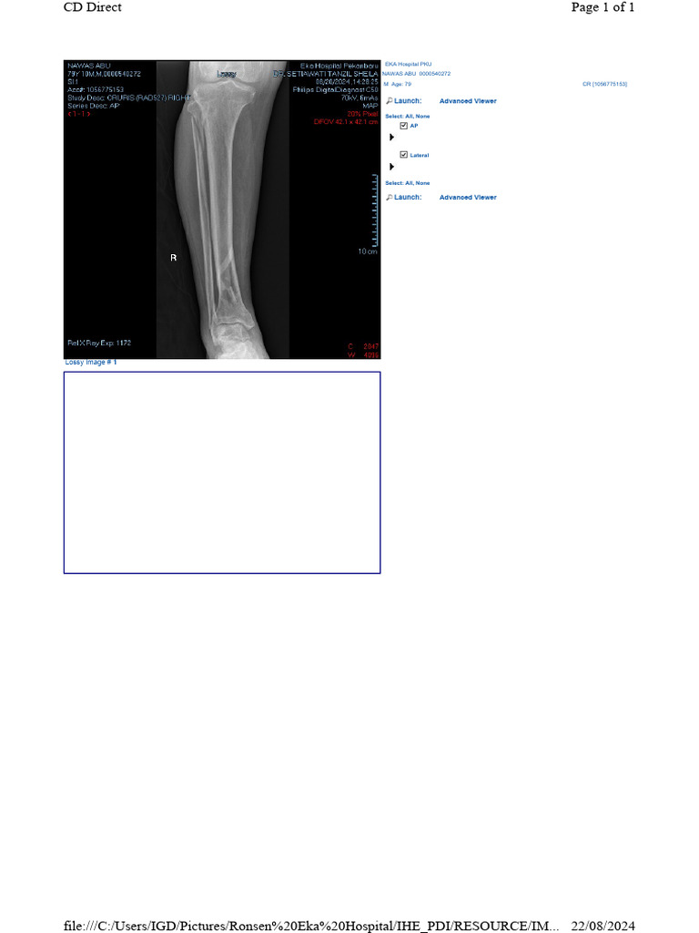 Ronsen Image Report for EKA Hospital | PDF