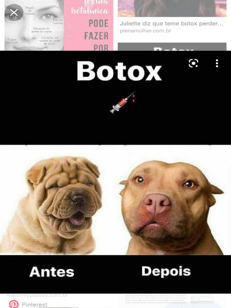 toxina botulínica botox meme - Pesquisa Google | PDF