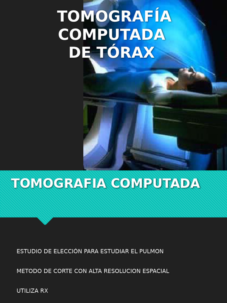 TC Torax | PDF | Pulmón | Neumología
