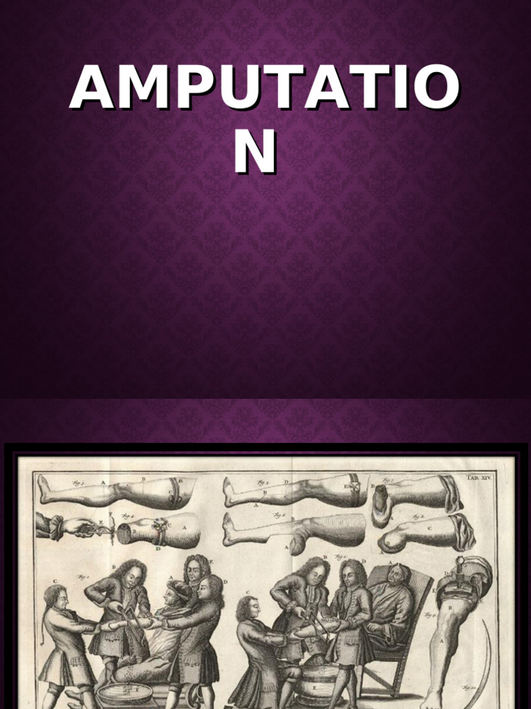 Amputation and Stages | PDF | Amputation | Pain
