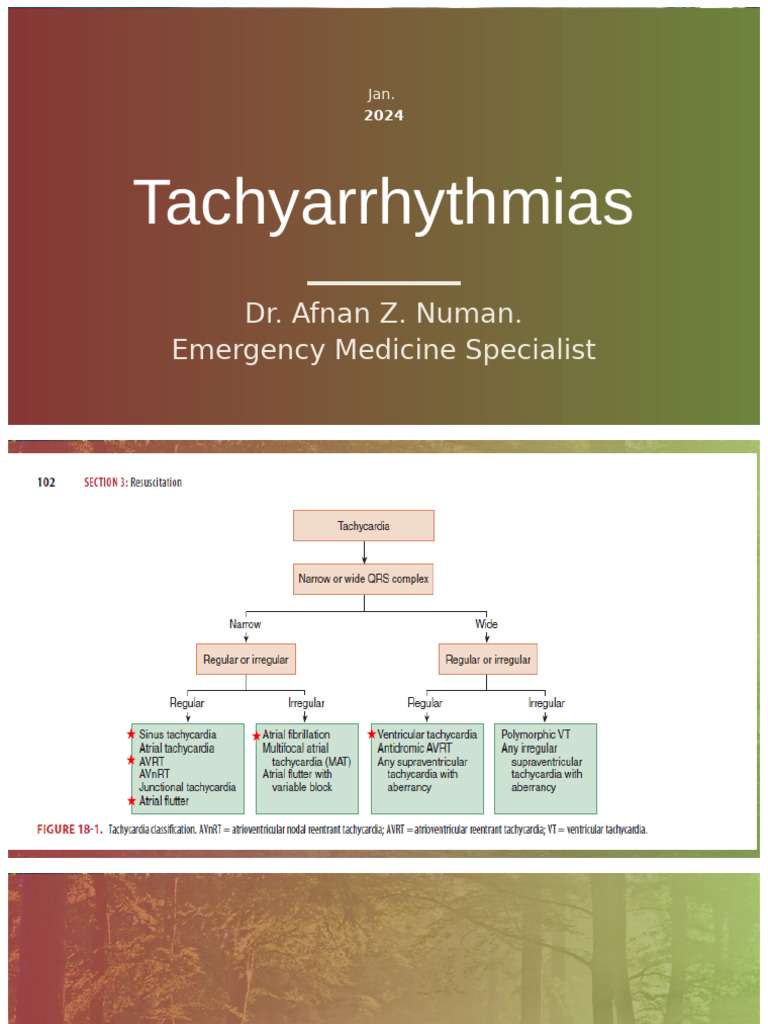 Tachyarrhythmias For Post Graduate | PDF