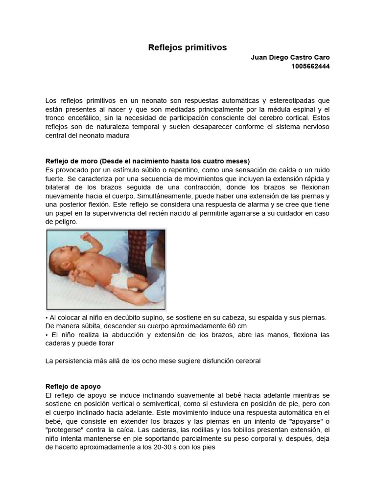 Reflejos Primitivos en Neonatos | PDF
