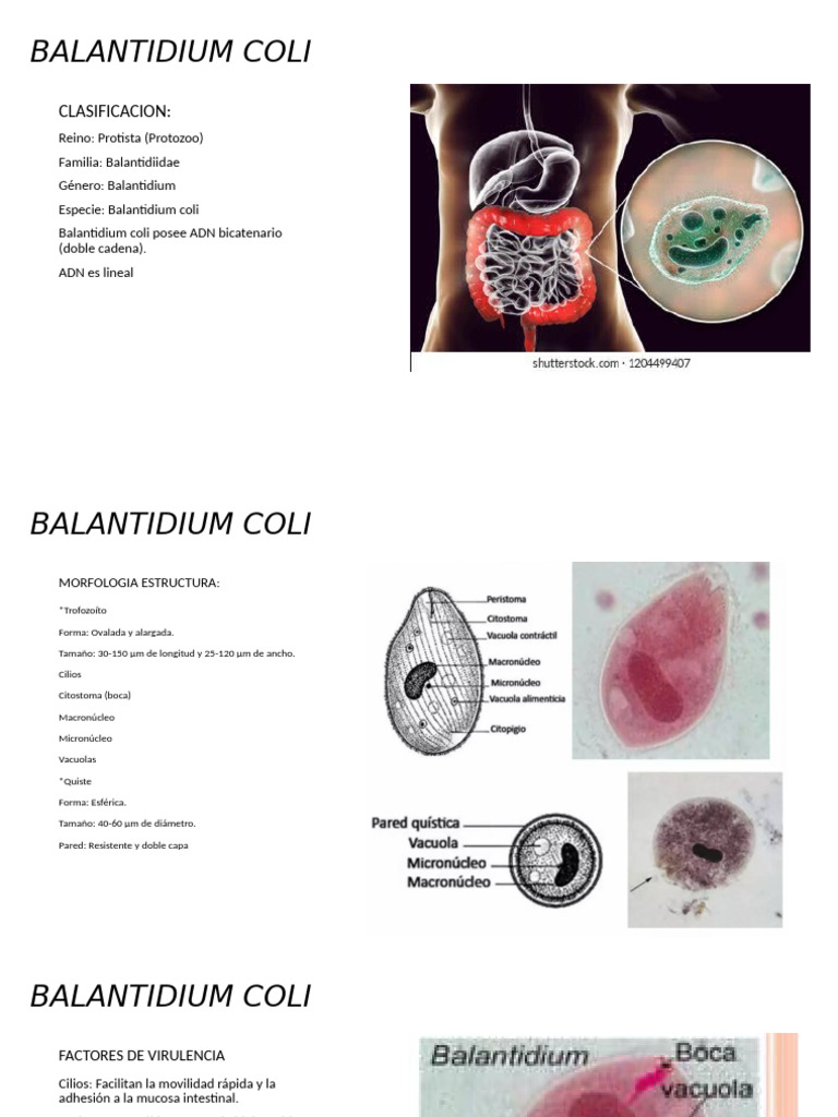 Balantidium coli: Guía Completa | PDF | Medicina CLINICA | Enfermedades ...