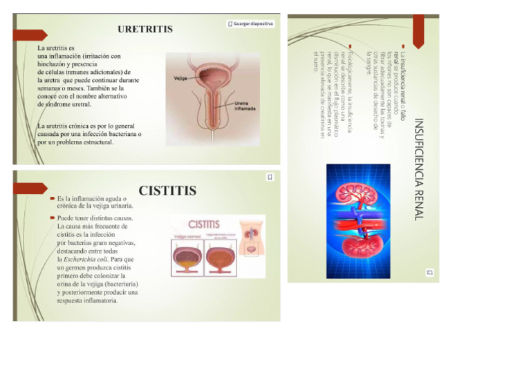 emfer excrector | PDF