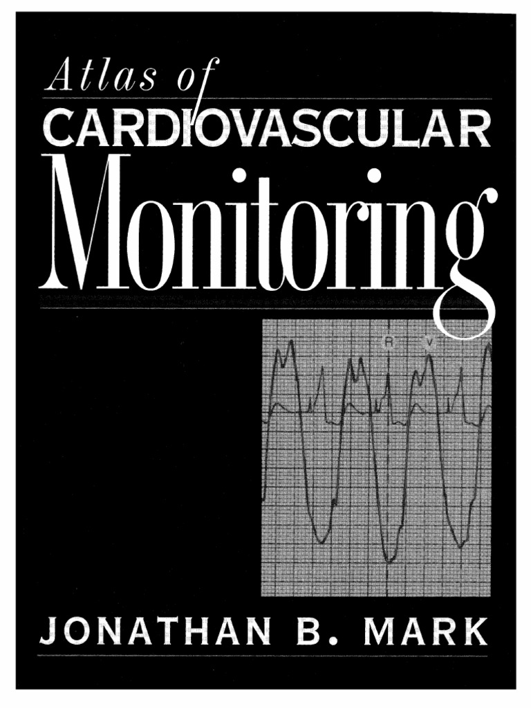 Atlas of Cardiovascular Monitoring | PDF