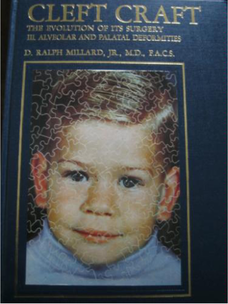 Cleft Craft The Evolution of Its 3 | PDF | Tongue | Epithelium