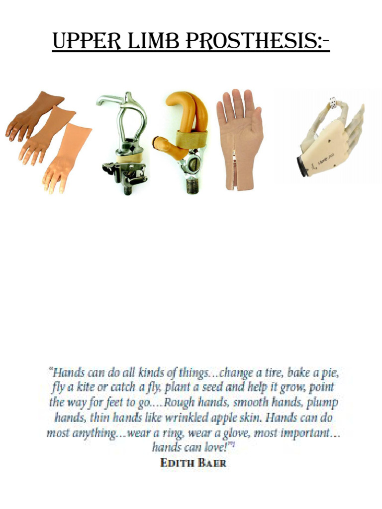 Prosthesis of Upper Limb | PDF | Prosthesis | Amputation