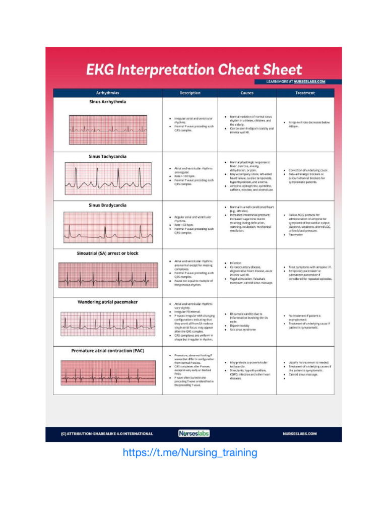 EKG Interpretation Cheat Sheet | PDF