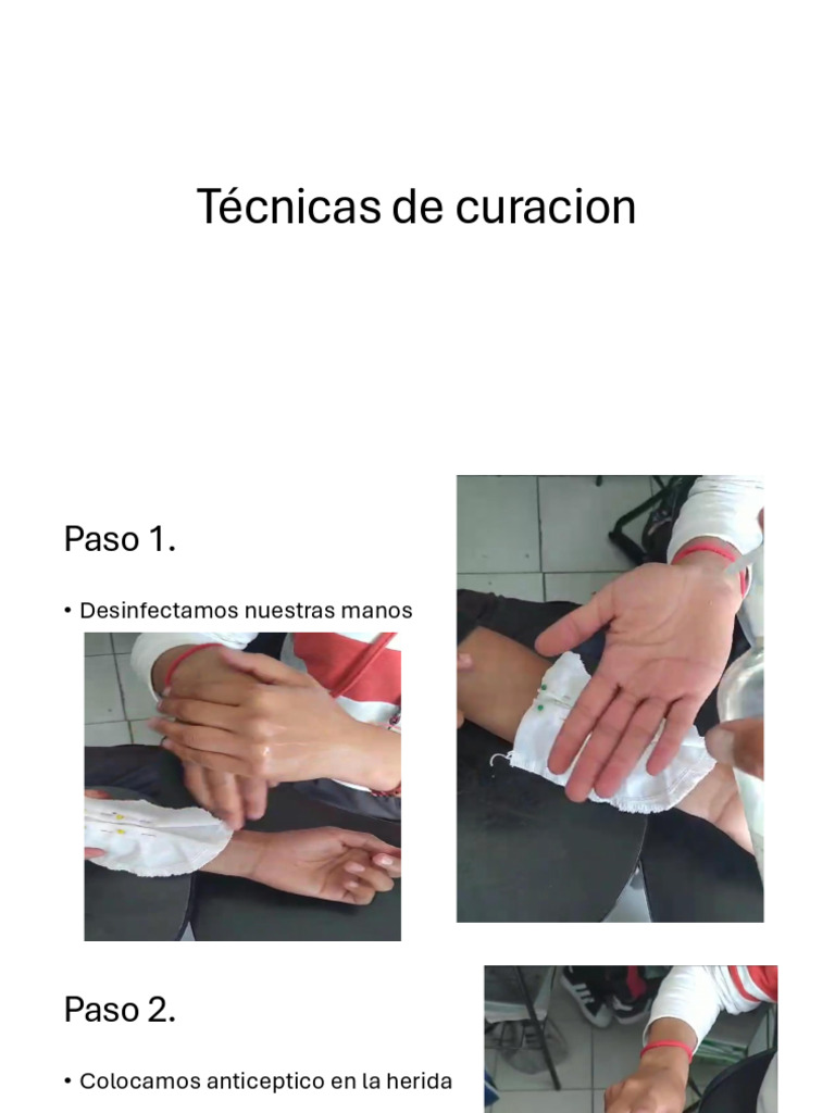 Tecnica de Curación | PDF