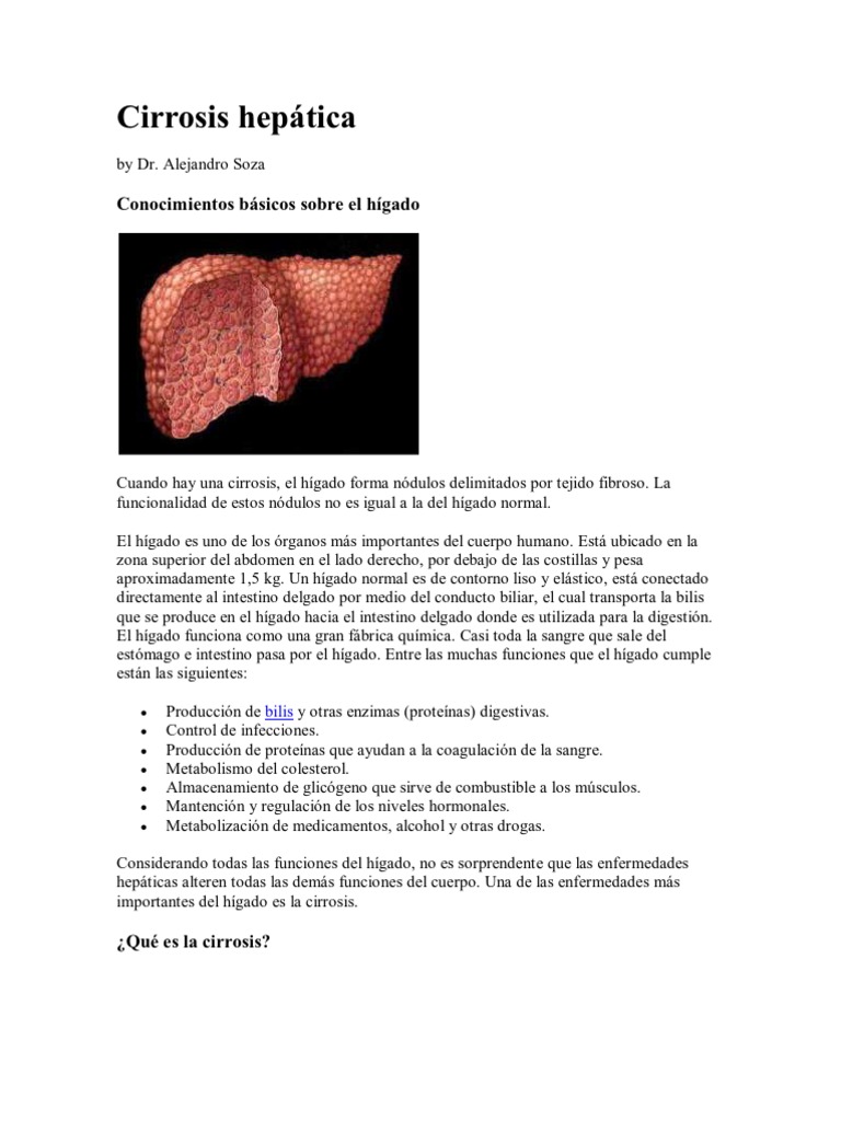 Cirrosis Hepática | PDF | Cirrosis | Hepatitis