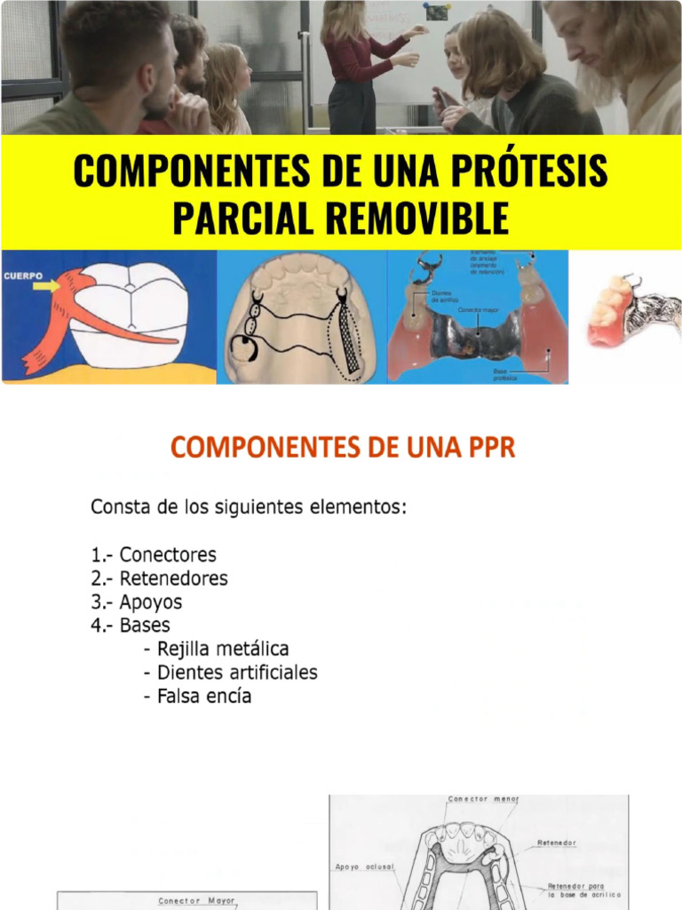 Componentes PPR | PDF