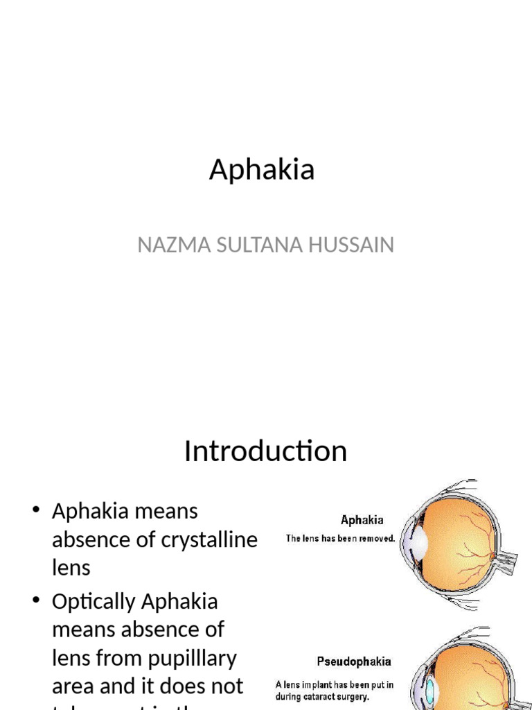 Aphakia- | PDF | Eye | Cornea