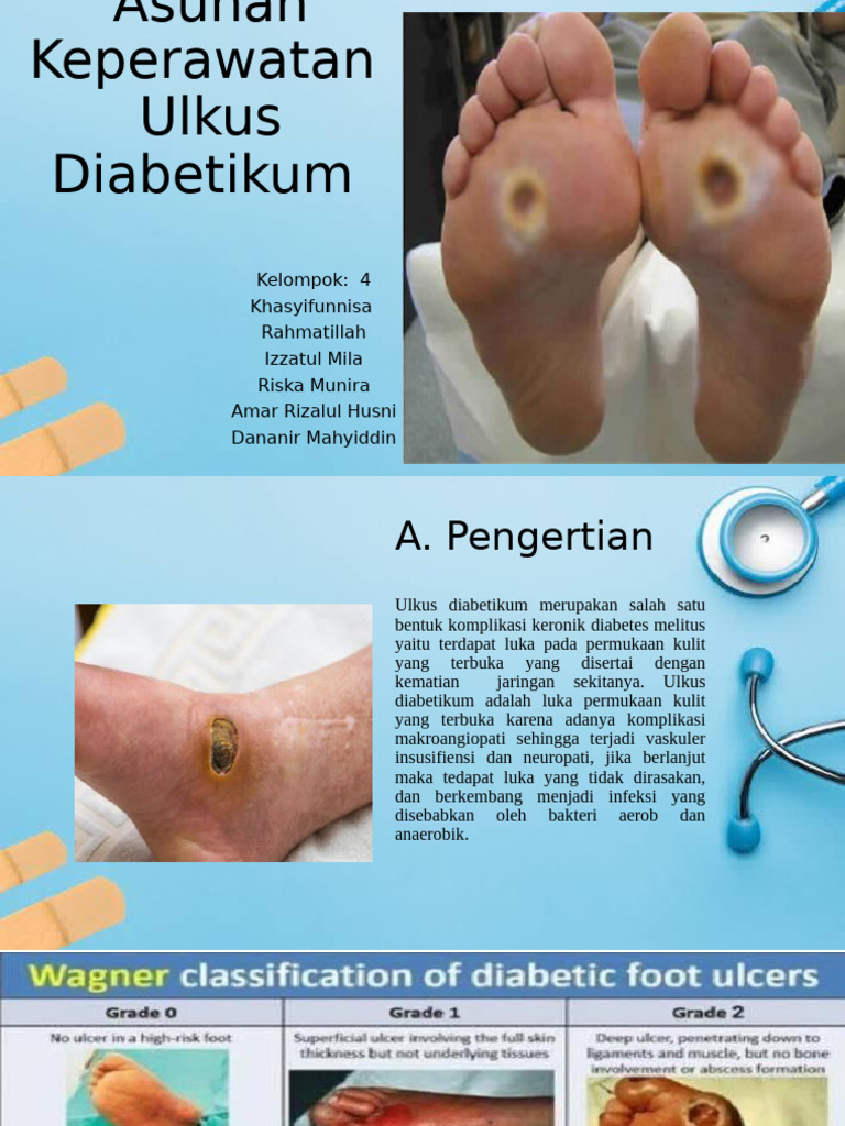 Asuhan Keperawatan Ulkus Diabetikum | PDF