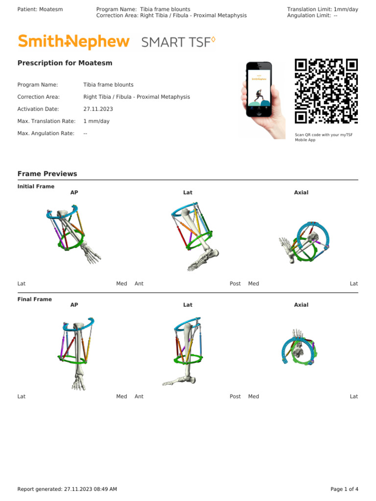 Tibia Frame Blounts Prescription Patient | PDF | Lower Limb Anatomy ...