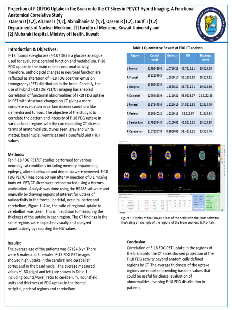 Projection FDG-CT Brain P1232 230213 | PDF | Positron Emission Tomography | Ct Scan