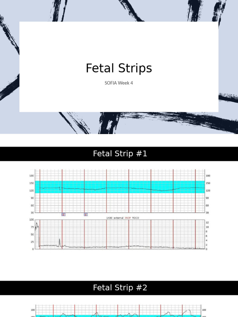 Fetal Strips | PDF