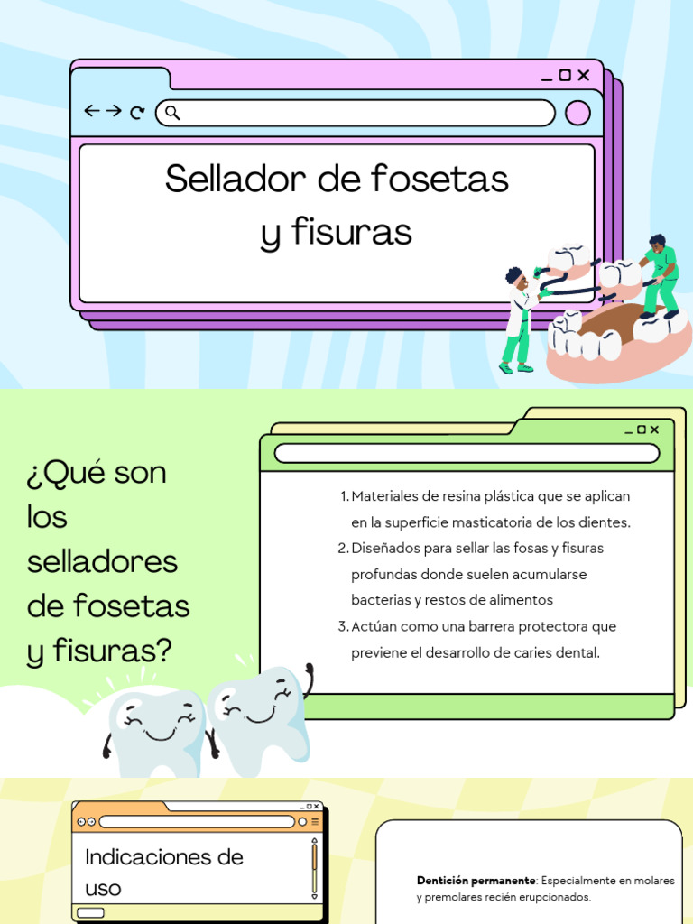 Selladores de Fosetas y Fisuras Dentales | PDF | Diente | Odontología