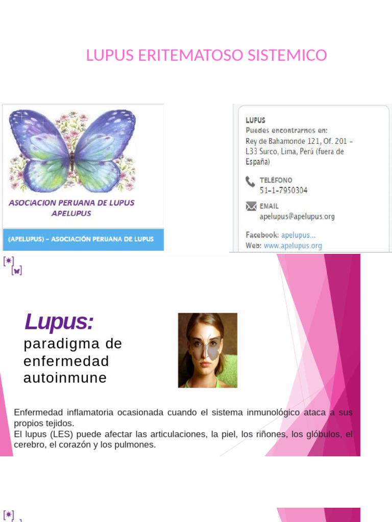 10 Lupus 0001 | PDF | Sistema inmune | Epidemiología