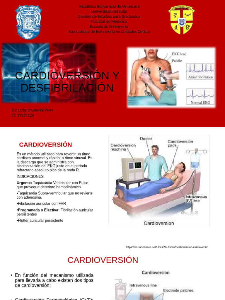 Cardioversión y Desfibrilación Con Videos | PDF | Corazón | Cardiología