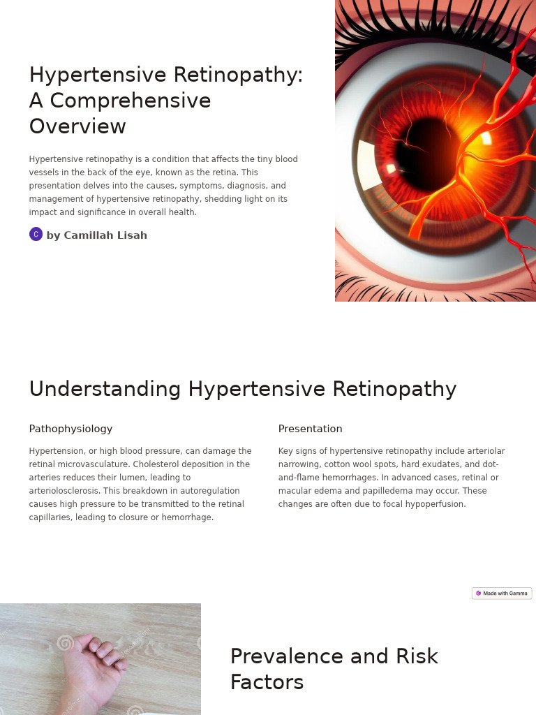 Hypertensive Retinopathy a Comprehensive Overview | PDF | Hypertension ...