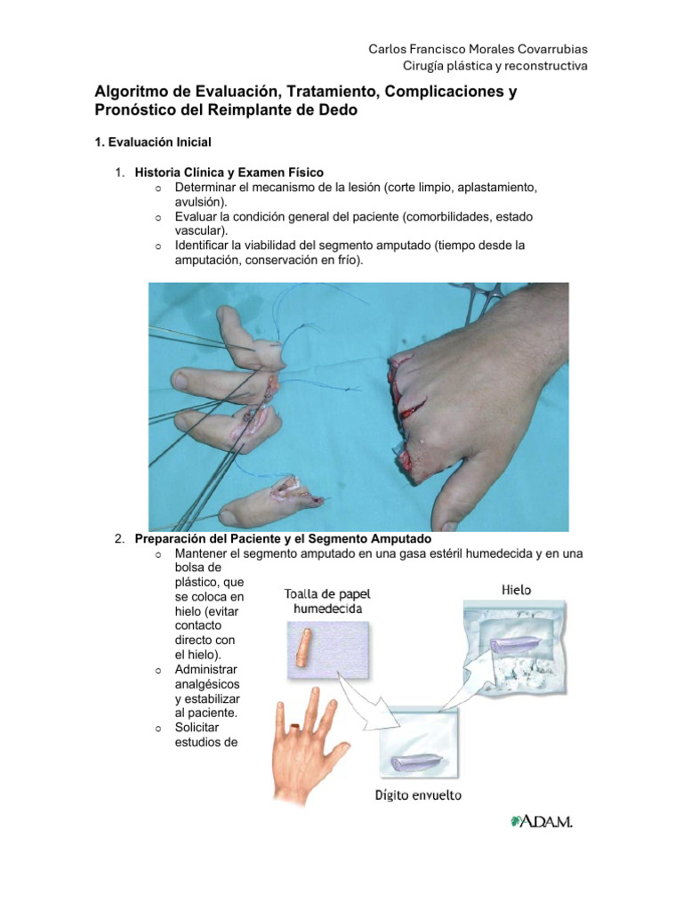 Algoritmo de Reimplante de Dedo | PDF | Cirugía | Amputación