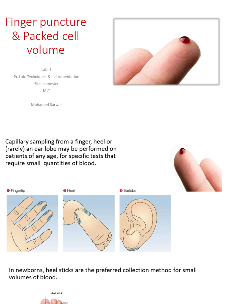 pr. Lab tech 3 | PDF | Blood | Body Fluids