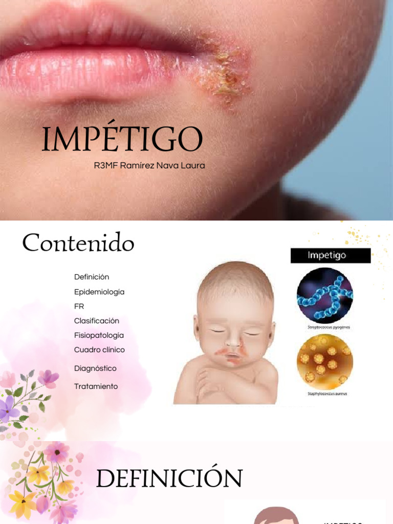Impétigo: Epidemiología y Tratamiento | PDF | Inmunología | Medicina