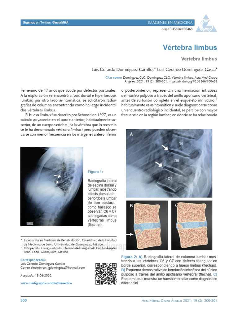 LECTURA_ VERTEBRA LIMBUS | PDF | Vértebra | La columna vertebral
