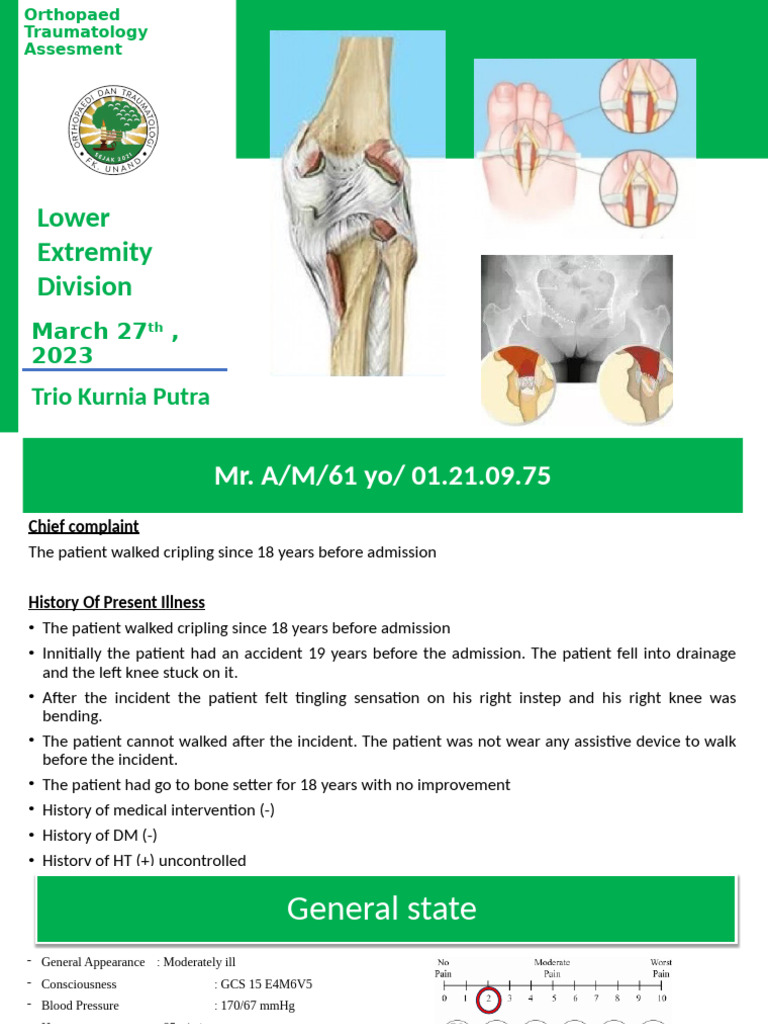 Lower Extremity, Case, Neglected Right Knee Joint + Equinus Contracture ...