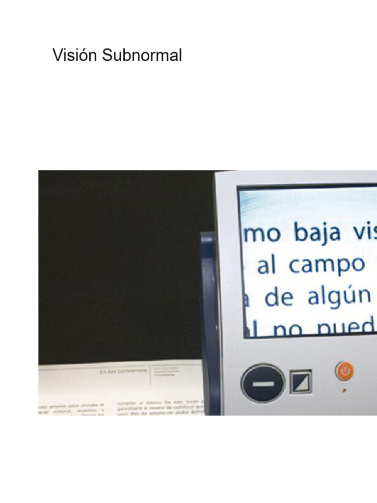 Vision, Subnormal y Ortóptica | PDF | Lente de la cámara | Lentes