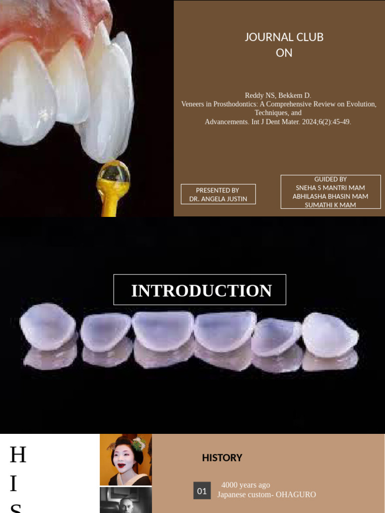 VENEERS | PDF | Dental Anatomy | Tooth