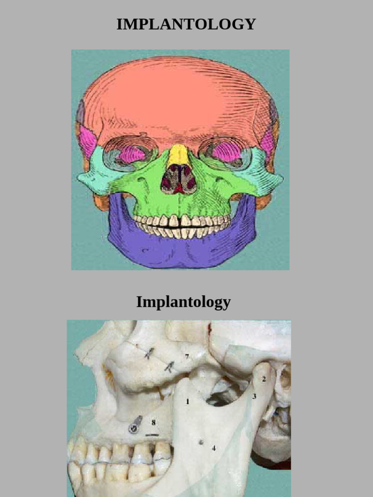 Implantology.2.Introduction to DDS IV 2024 | PDF | Dental Implant | Medical Specialties