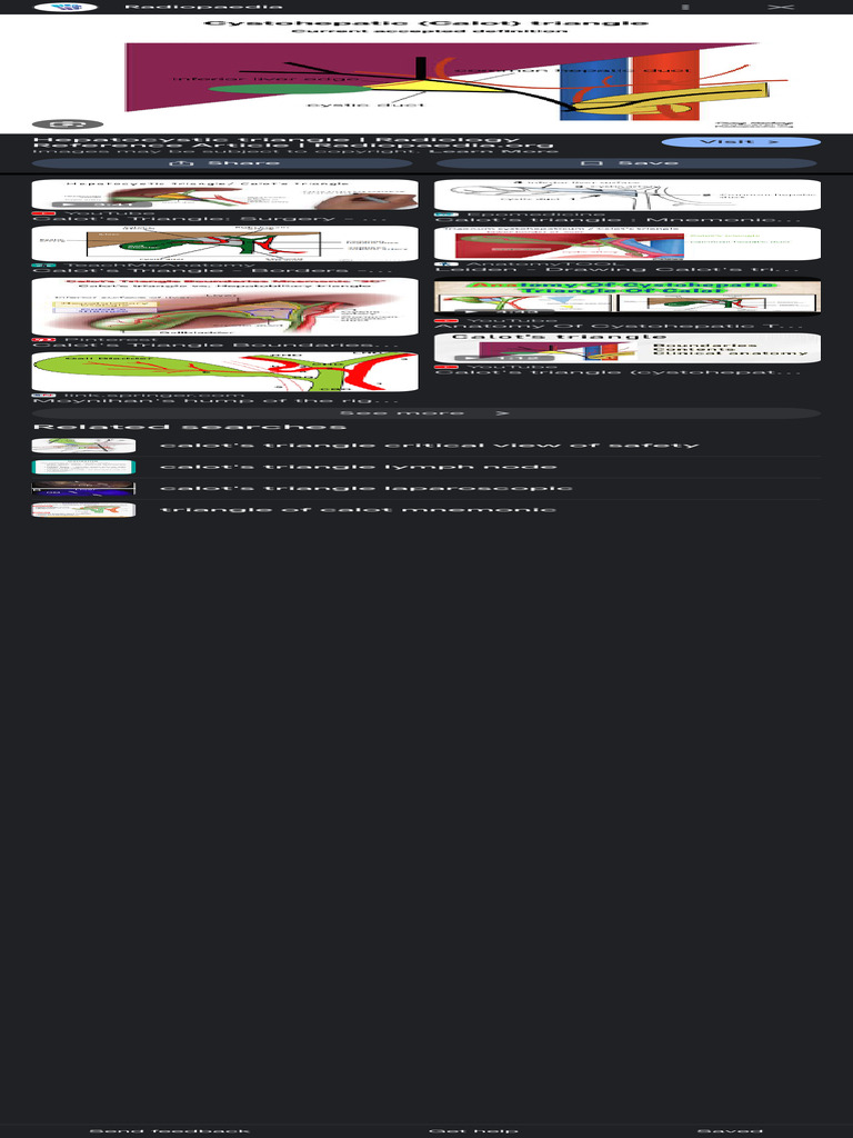 Calot Triangle - Google Search | PDF