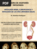 Obstrucción y Estasis Urinaria: Diagnóstico y Tratamiento | PDF ...