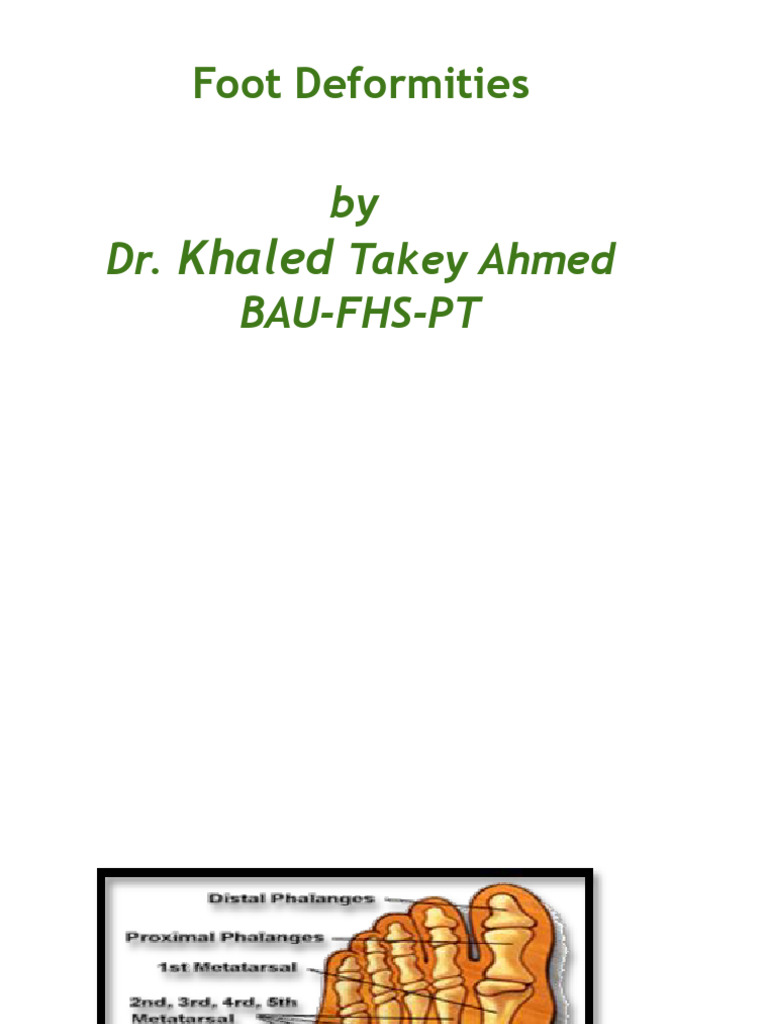 Foot Deformities | PDF | Foot | Human Anatomy