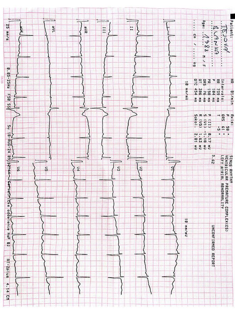 EKG | PDF