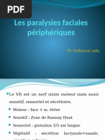 Fracture Du Rocher DR Amarache 2016 | PDF | vertige | Traumatisme crânien