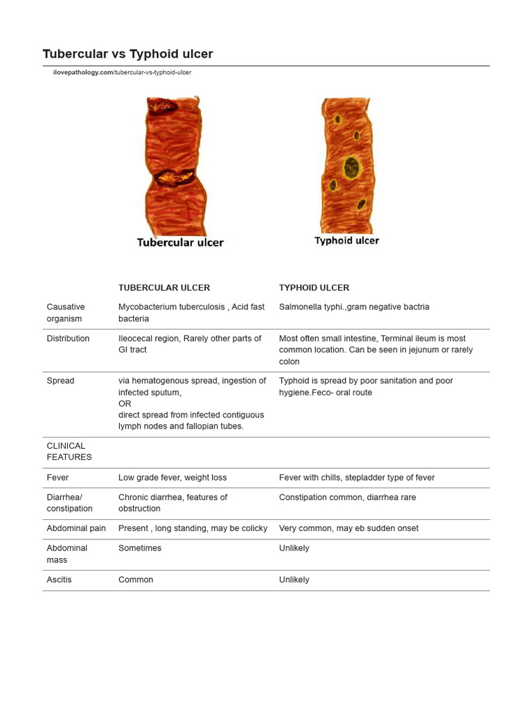 Tubercular Vs Typhoid Ulcer - Pathology Made Simple | PDF