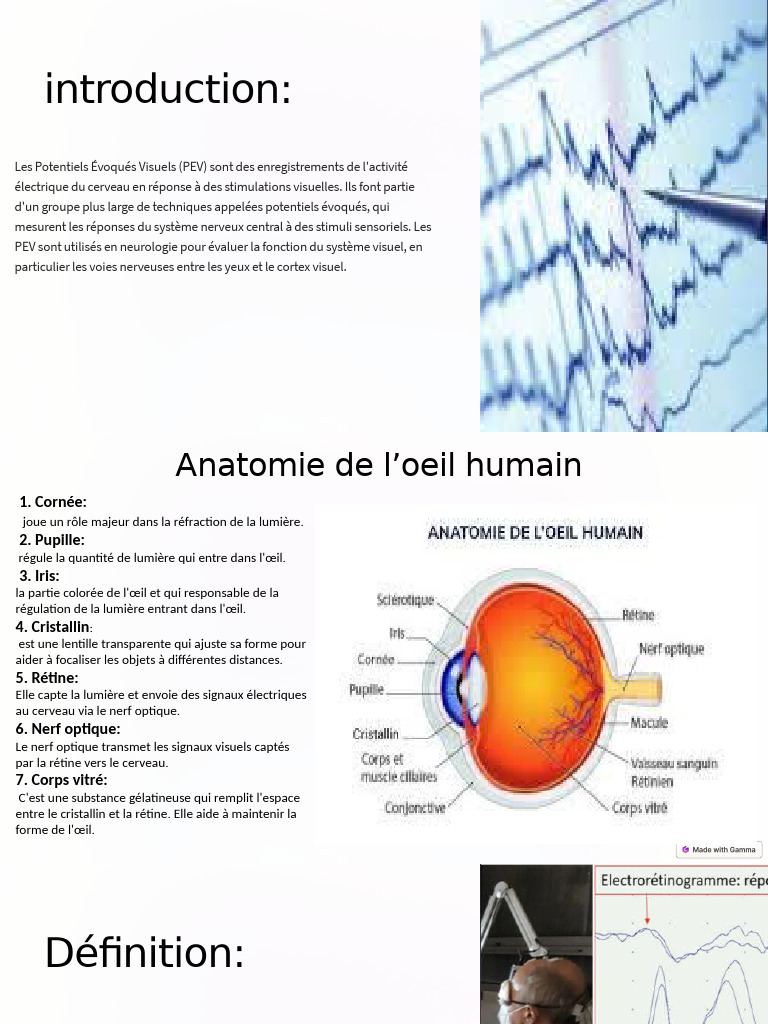 Les Potentiels Evoques Visuels PEV 1 1 | PDF | Œil humain | Cerveau