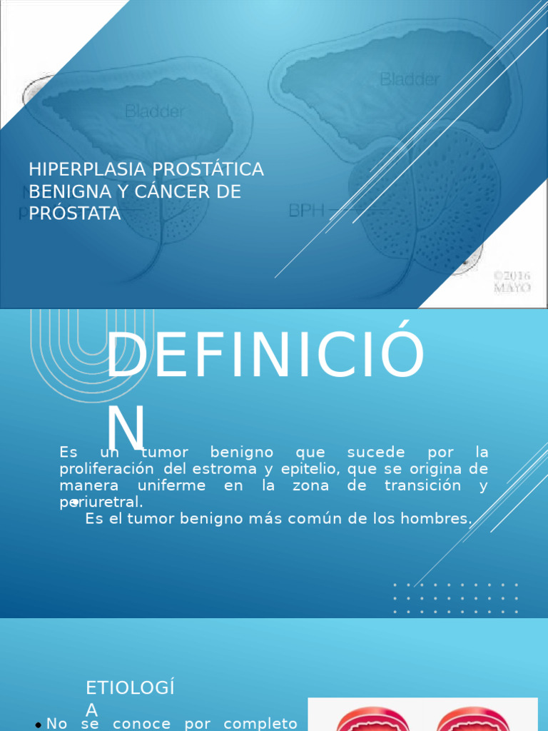 HPB 2 | PDF | Cancer de prostata | Medicina CLINICA