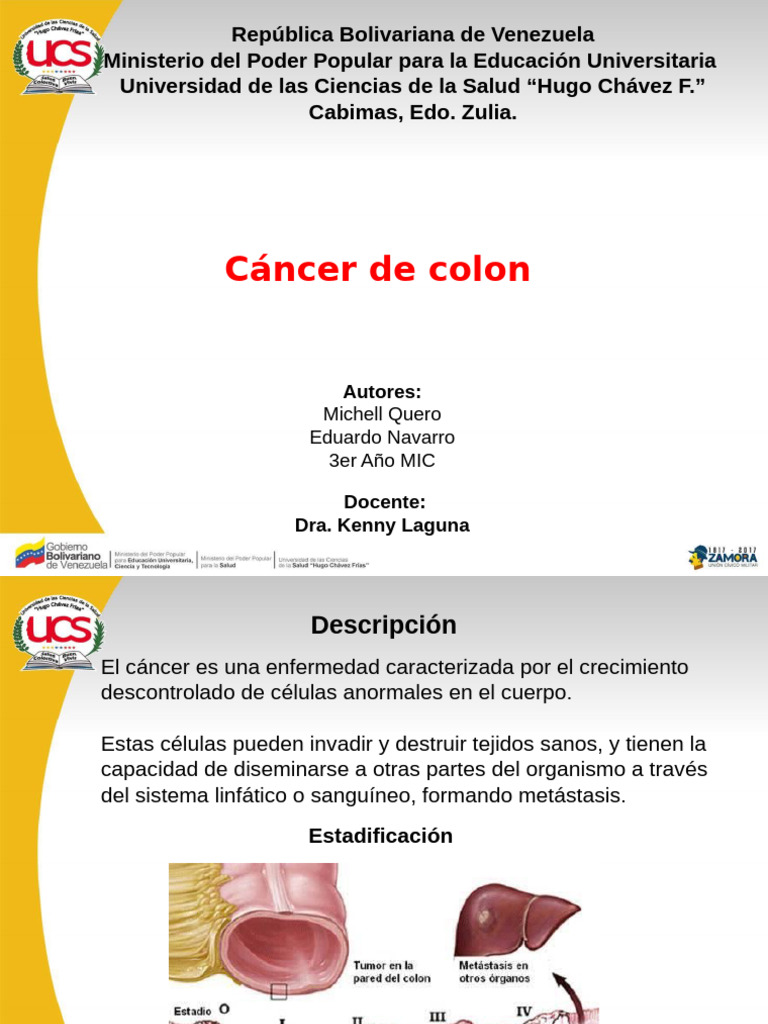 Cáncer de Colon: Etiología y Tratamiento | PDF | Cáncer | Cáncer ...