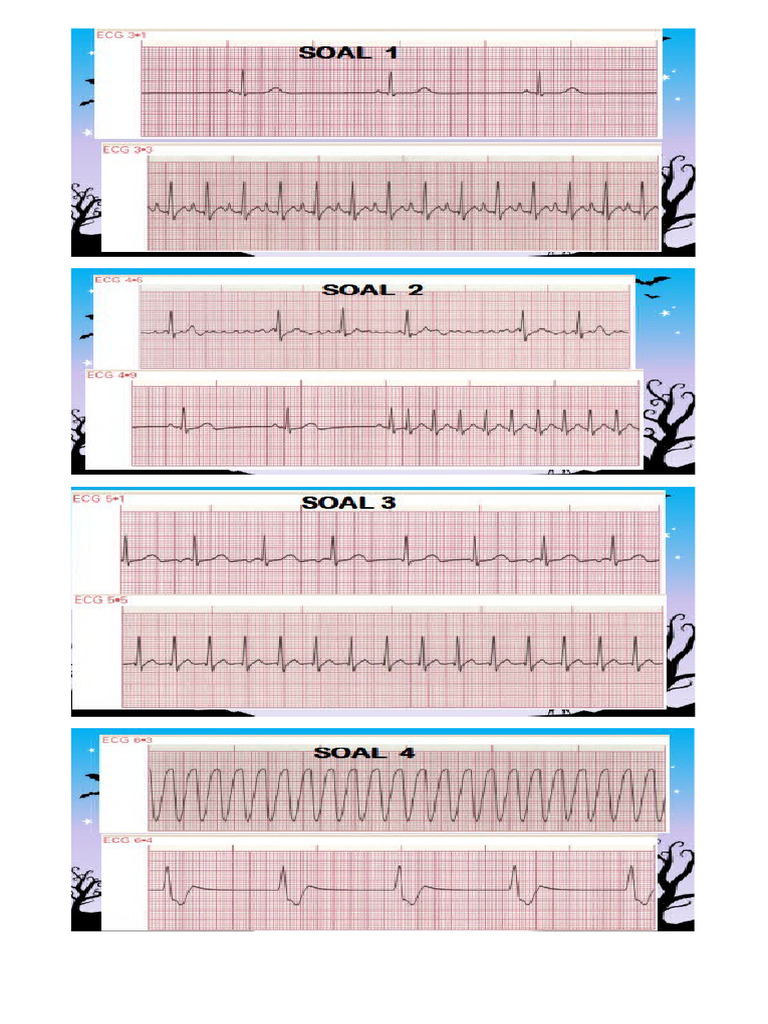 Latihan Interprestasi Ekg | PDF