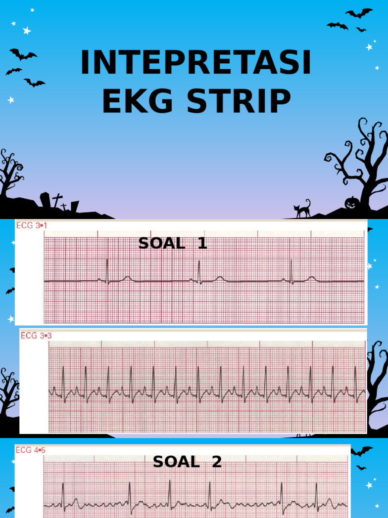 INTERPRETASI EKG LATIHAN | PDF