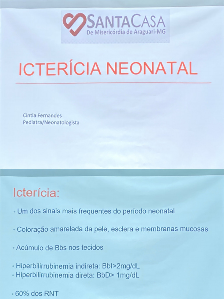 Icterícia Neonatal PDF | PDF