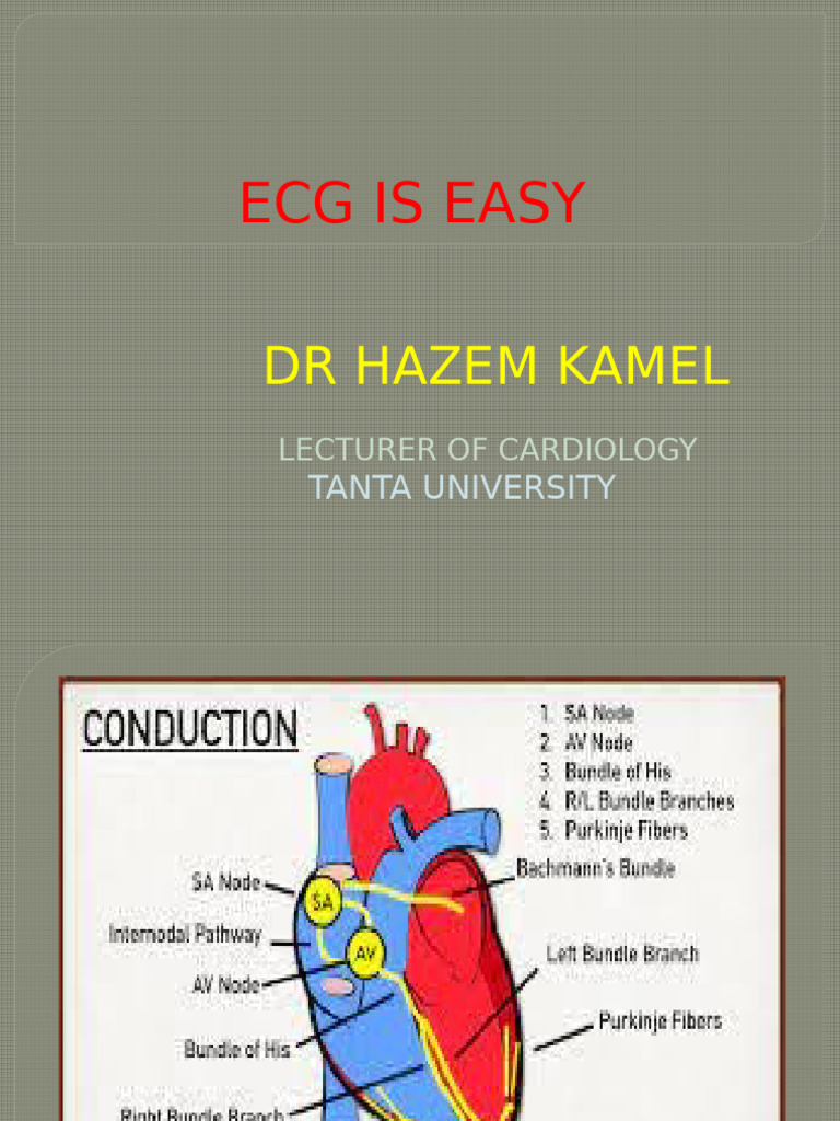 ECG IS EASY | PDF