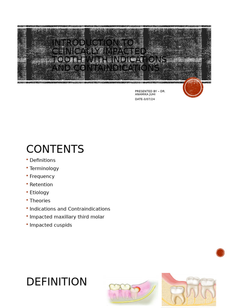 Introduction of Impaction | PDF | Human Tooth | Tooth