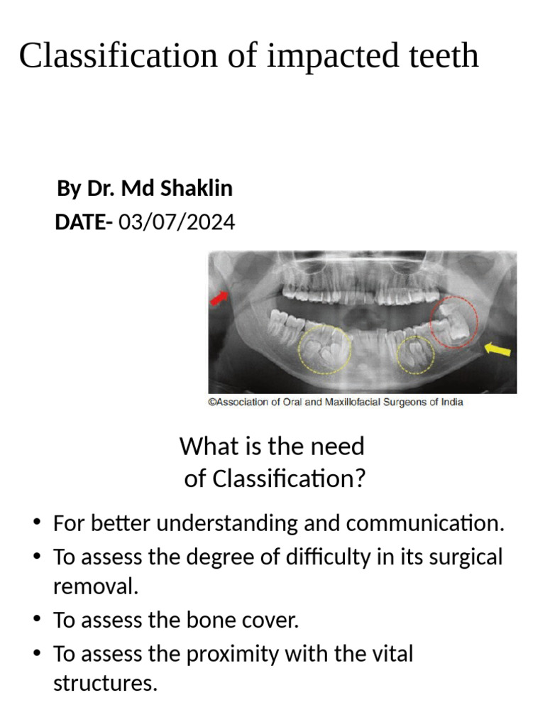 Classification of Impacted Teeth | PDF | Dentistry | Tooth