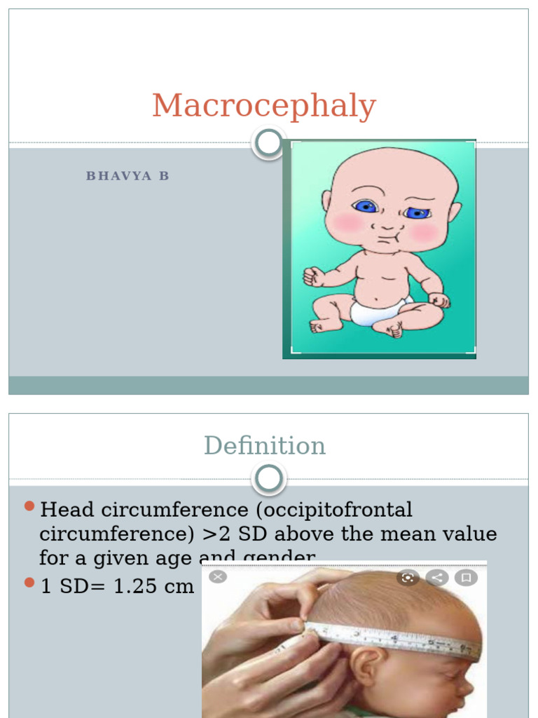 Macrocephaly | PDF