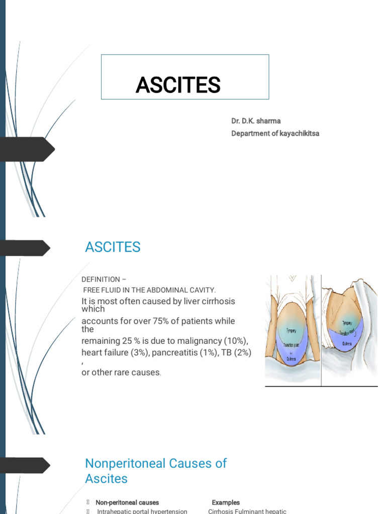 ASCITES | PDF | Cirrhosis | Medical Specialties