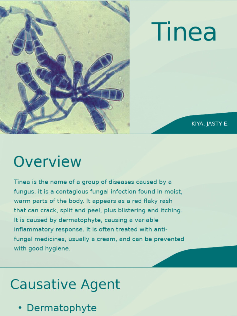 TINEA Jasty Kiya Travelbee | PDF | Microbiology | Dermatology